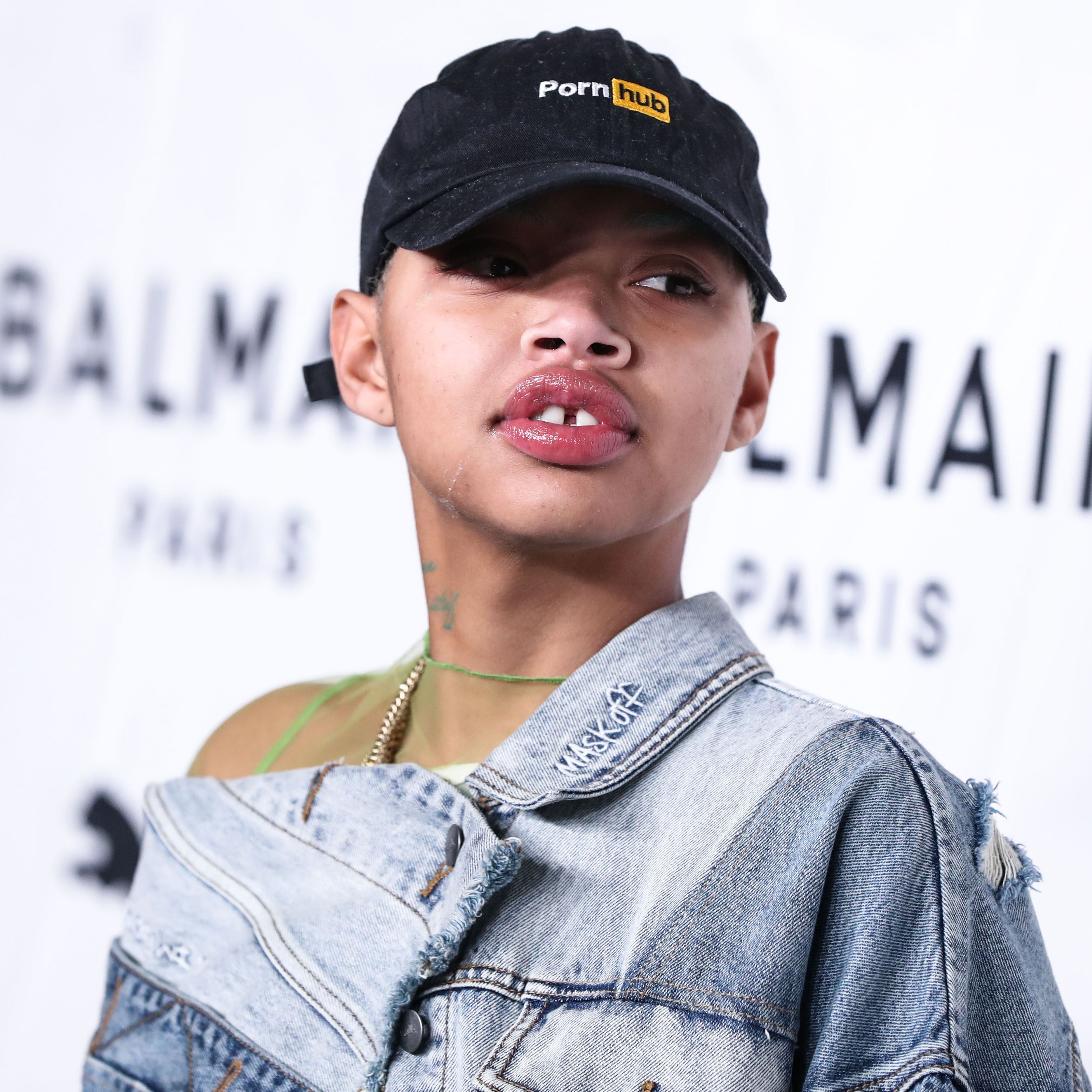 Model Slick Woods Suffers Seizure, Shows Swollen Face & Lips On ...